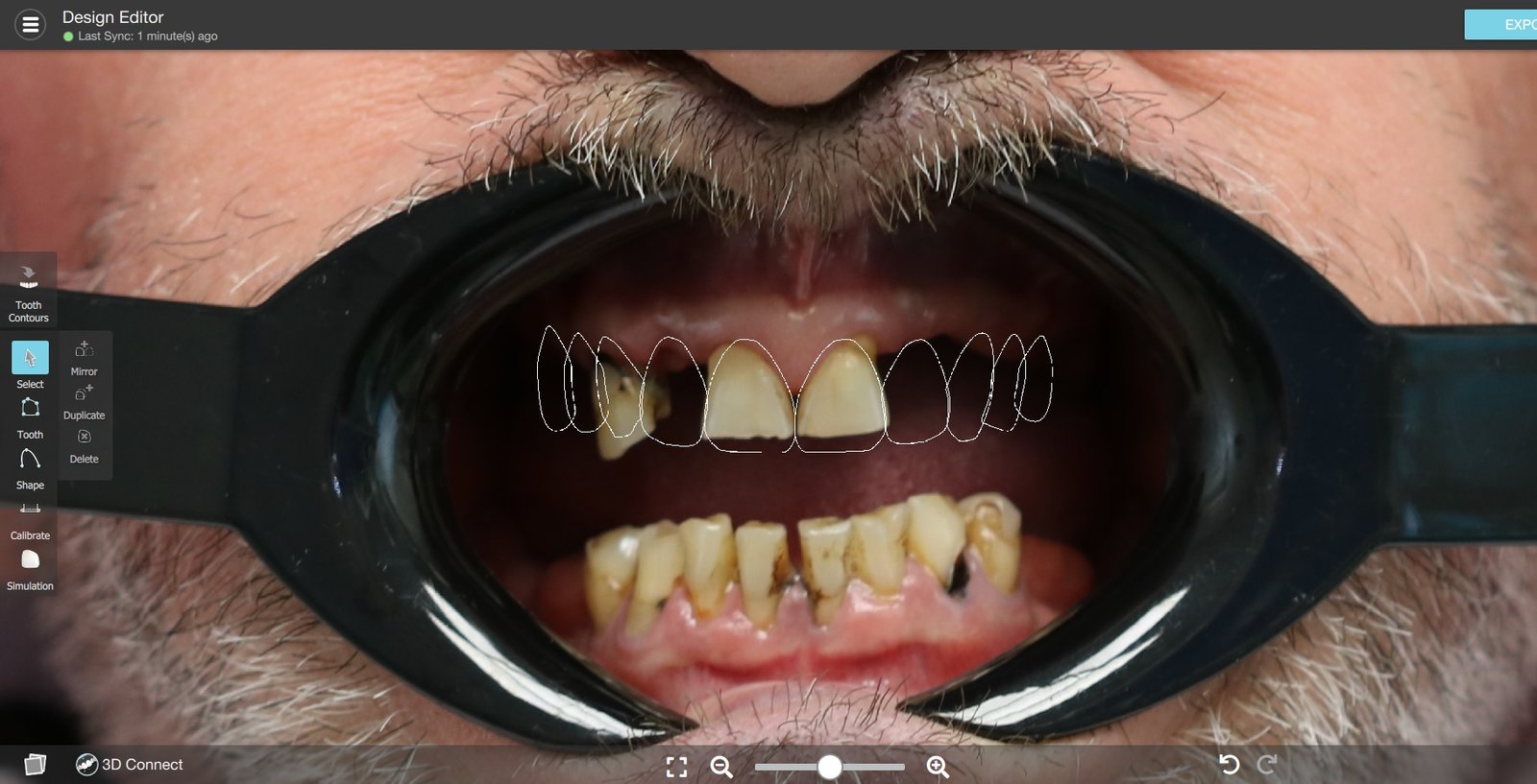 Full arch solutions - Open Dental Community