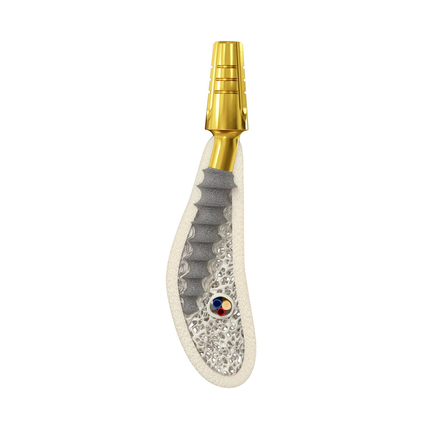 ROOTT Online - Open Dental Community